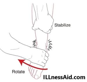 High Ankle Sprain: Causes, Diagnostic tests, & Treatment - ILLnessAid